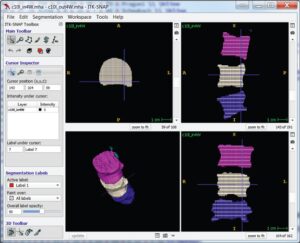 New ITK-SNAP Features Improve Segmentation