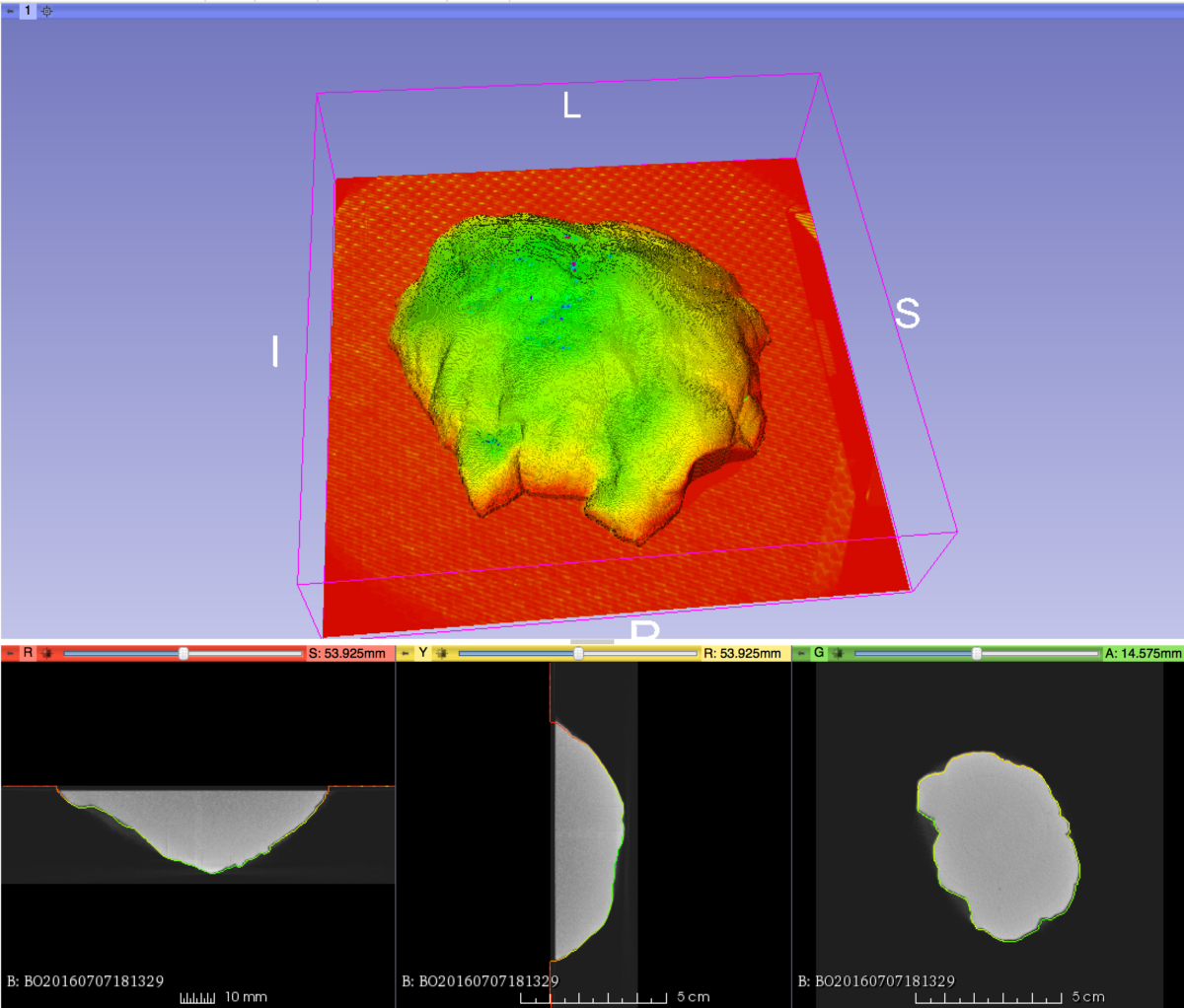 Kitware customer highlight: Optics in Medicine Laboratory