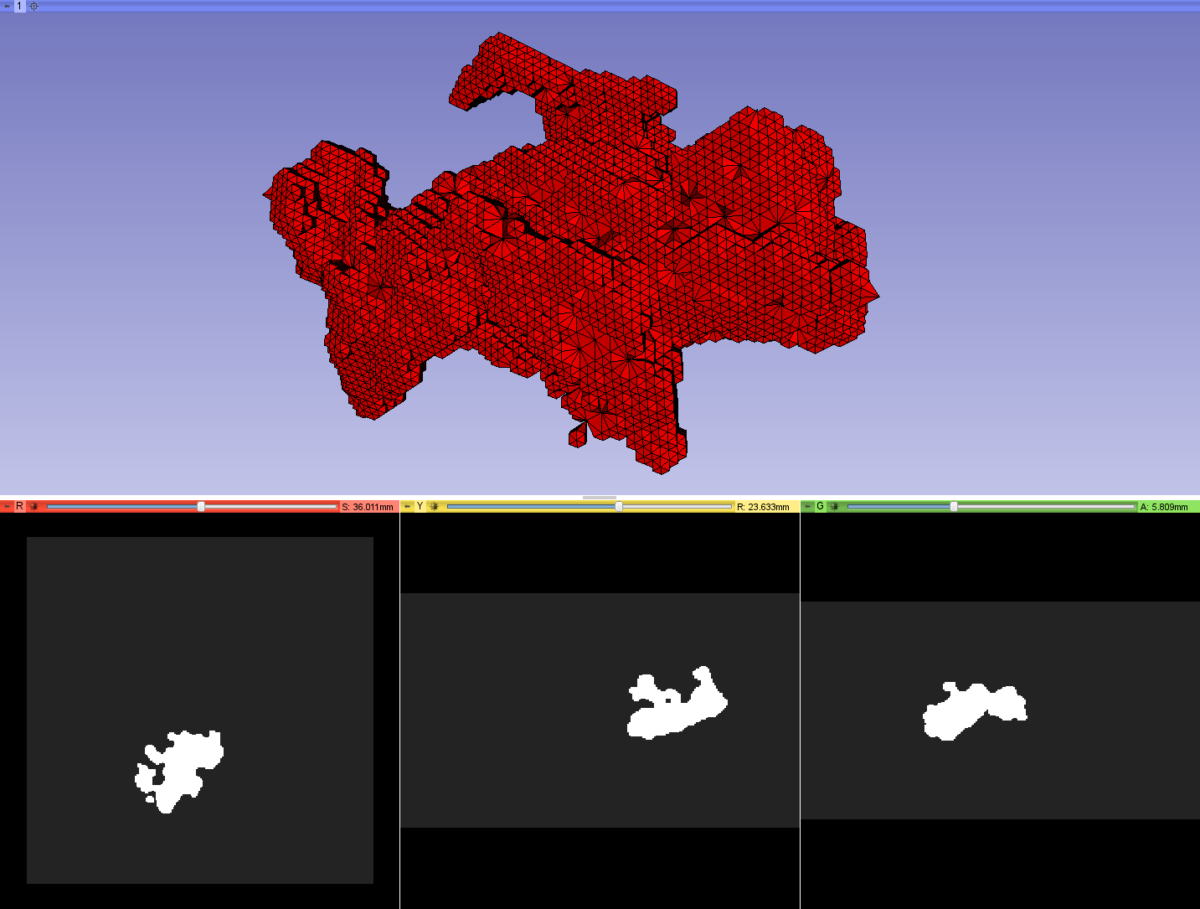 3D Slicer Adds Volumetric Mesh Support