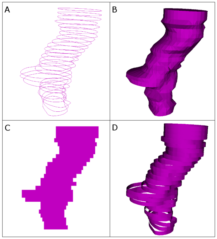 Novel Mechanism Segments Anatomical Structures for 3D Printing