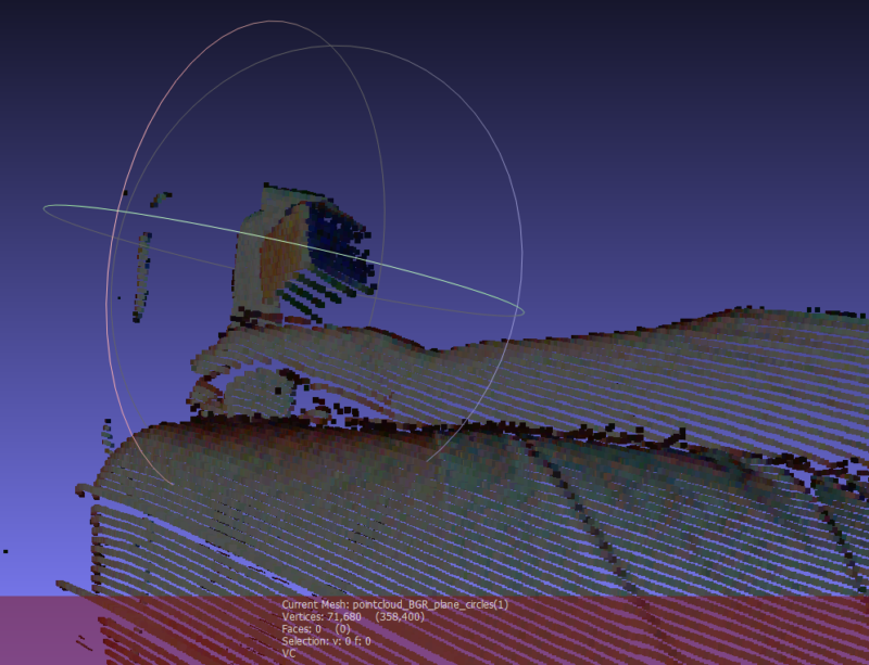 Ultrasound Augmentation: Rapid 3-D Scanning for Tracking and On Body ...