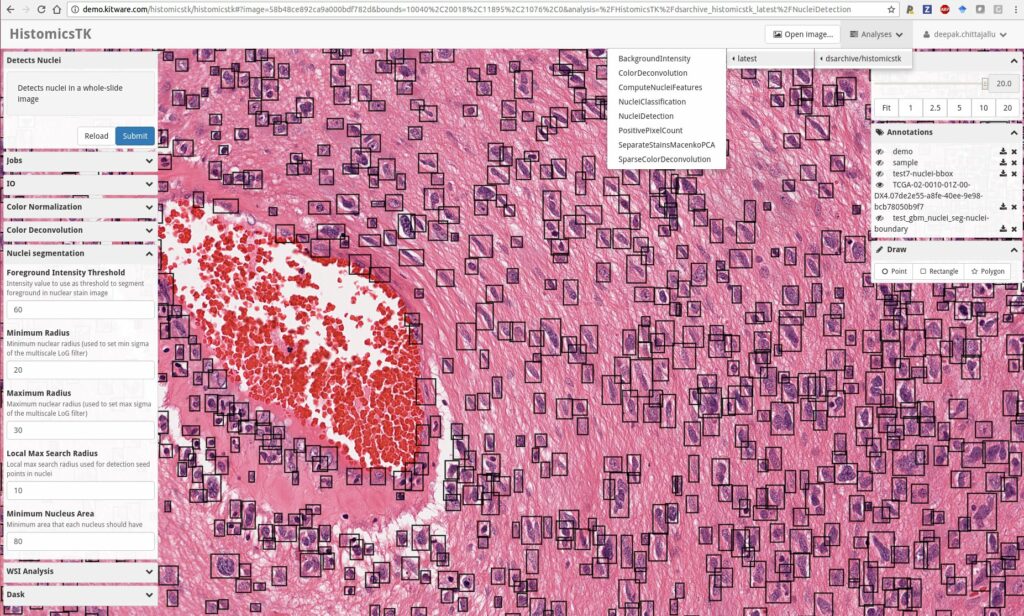 Digital Slide Archive Large Image And Histomicstk Open Source Informatics Tools For