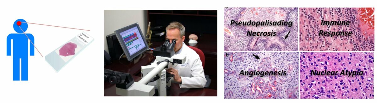 Digital Slide Archive, Large Image, and HistomicsTK: Open-source ...