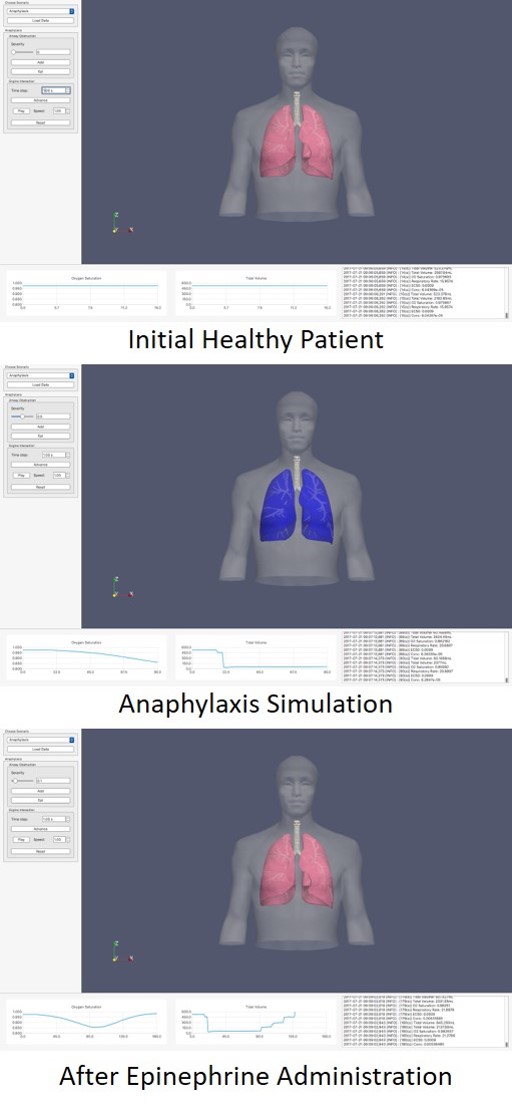 Visualizing an Anaphylaxis Physiology Simulation Using ParaView