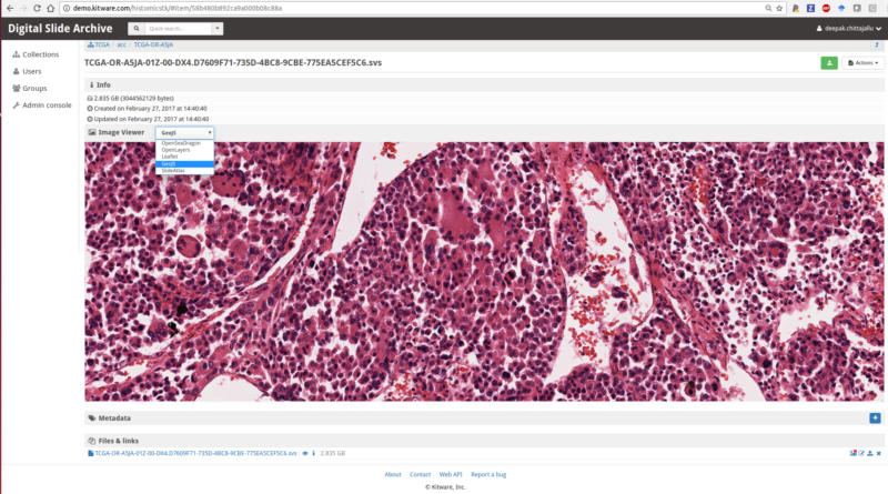 Digital Slide Archive, Large Image, and HistomicsTK: Open-source Informatics Tools for ...