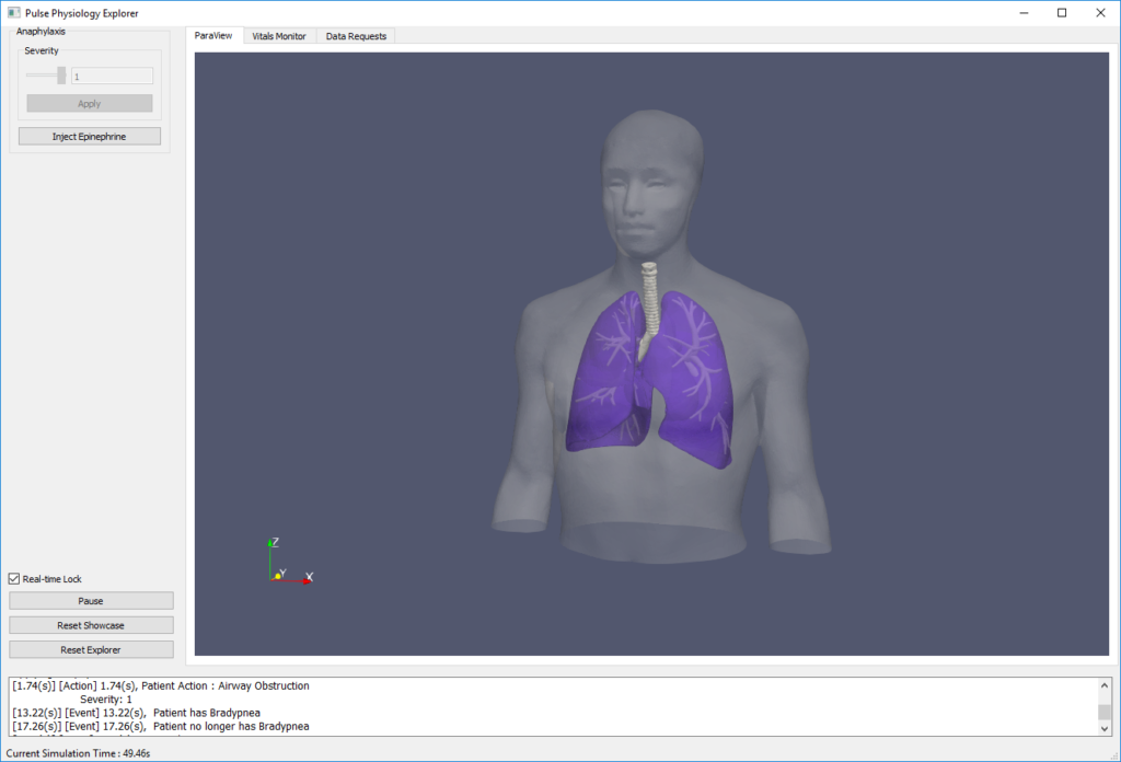 Visualizing an Anaphylaxis Physiology Simulation Using ParaView