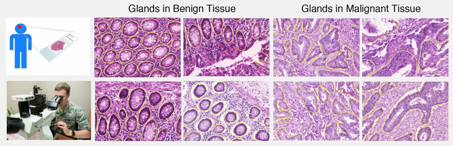 Characterizing Glandular Architecture for Cancer Diagnosis in ...