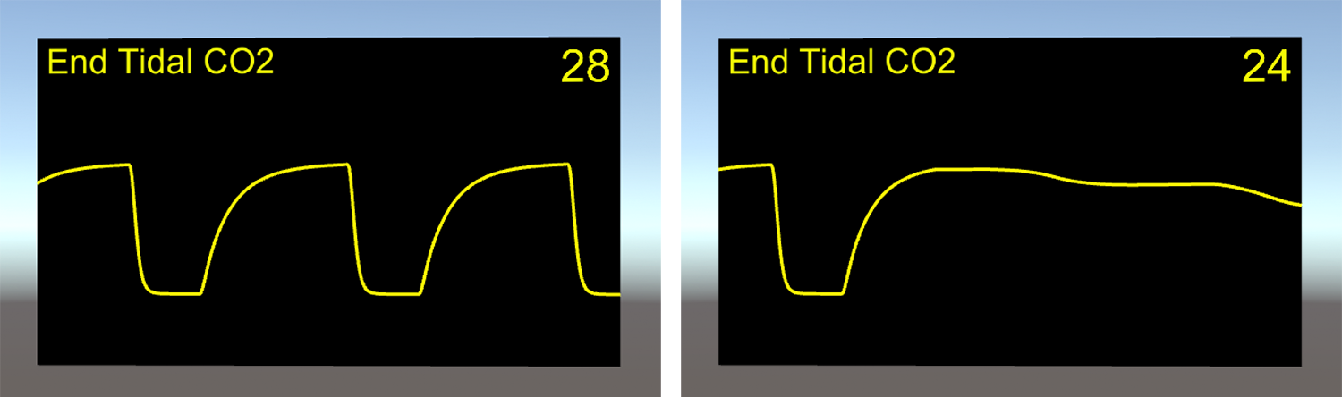 Pulse Is Now Available on the Unity Asset Store