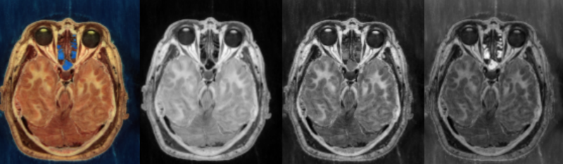Splitting ITK image channels