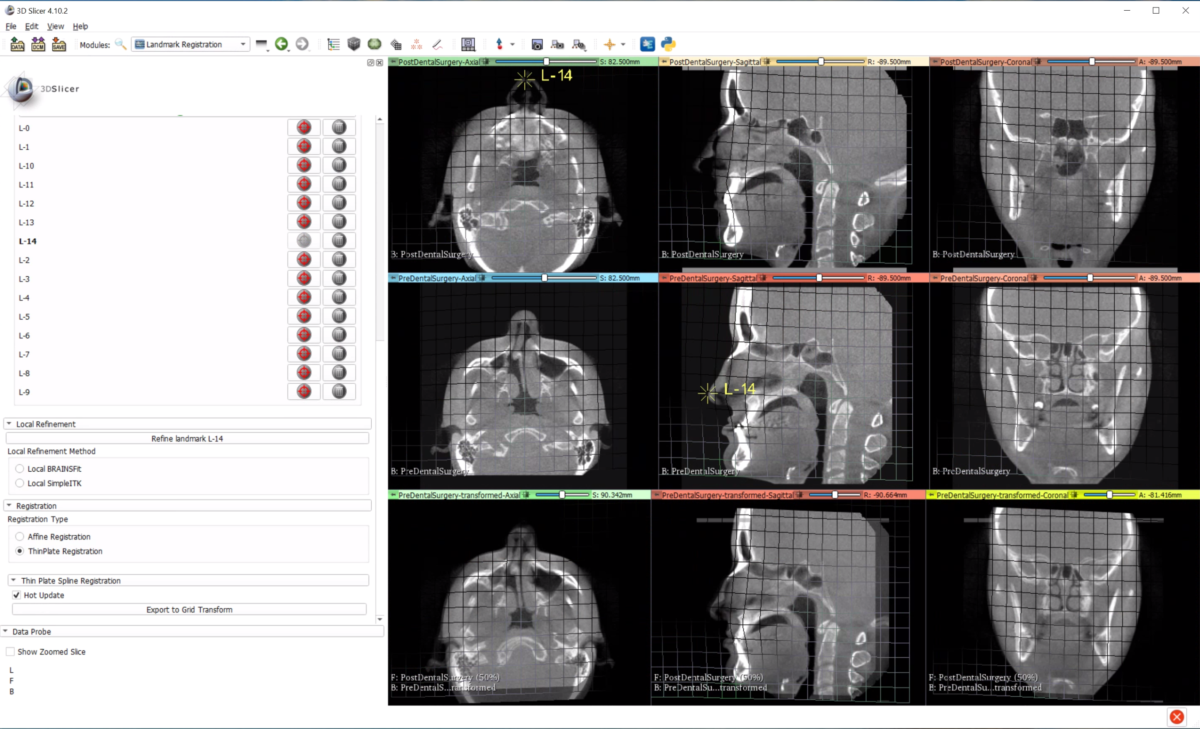 3D Slicer 4.10.2 available for download