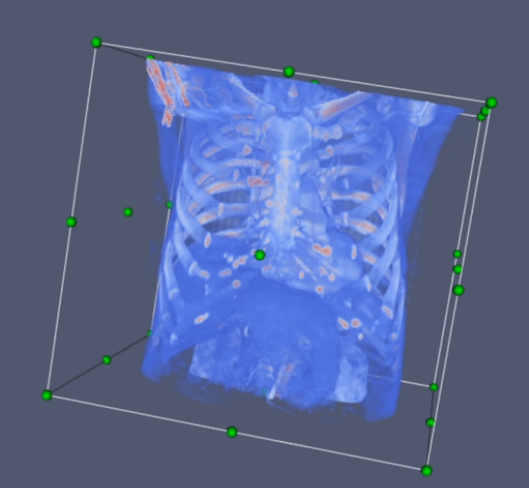 Vtkjs Video Tutorials Integrating Scientific Visualizations Into Ohif And Other Web Applications 4911