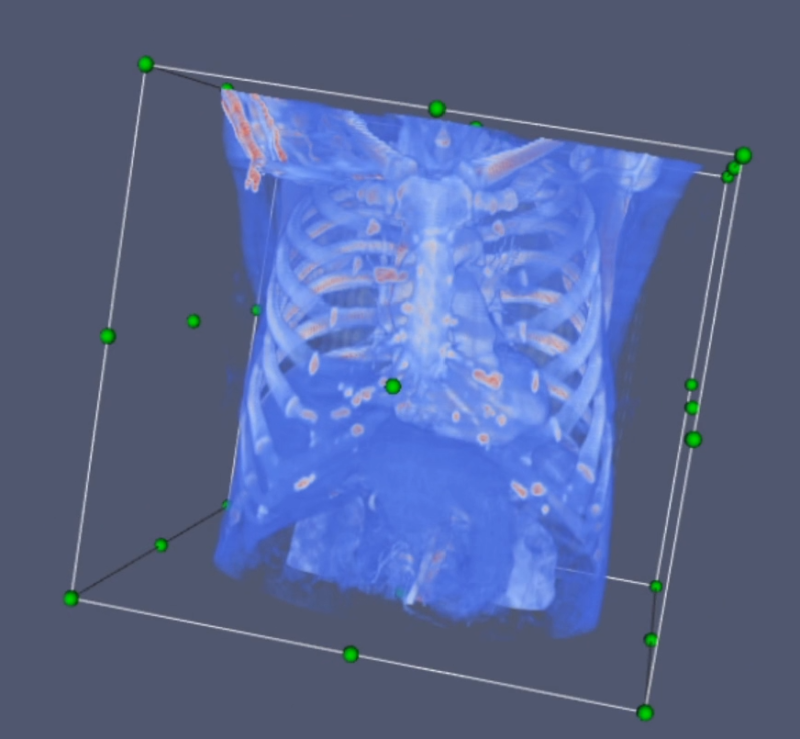 Vtk Js Video Tutorials Integrating Scientific Visualizations Into Ohif And Other Web Applications