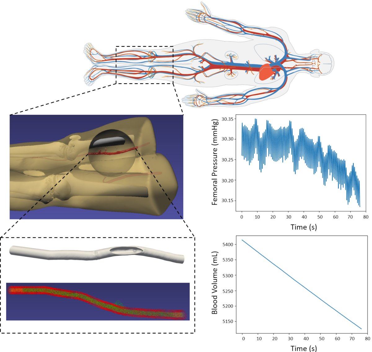 iMSTK Integrates Pulse Physiology Engine