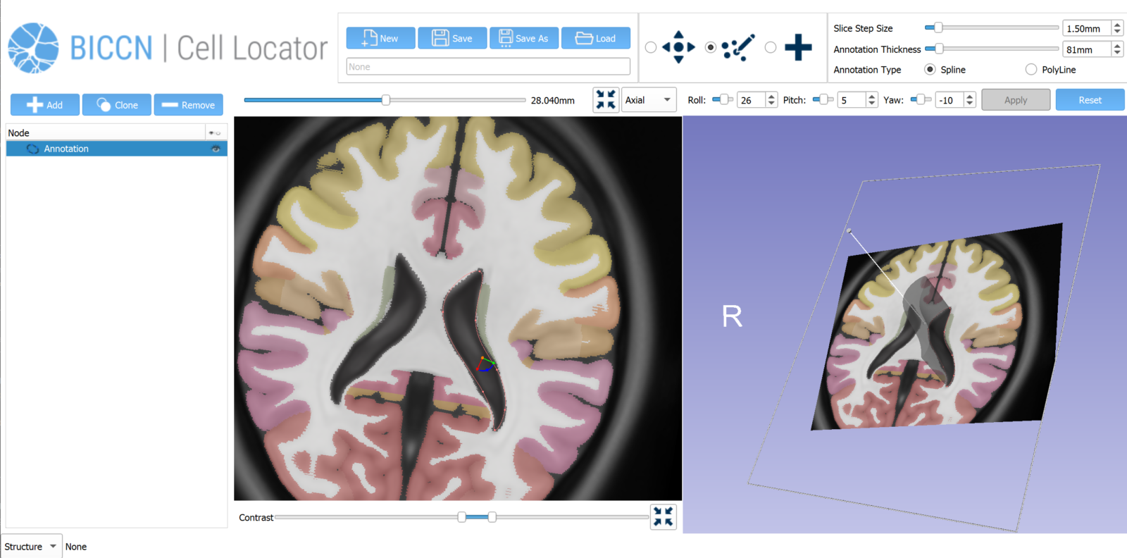 Cell Locator: Manually align specimens to annotated 3D spaces