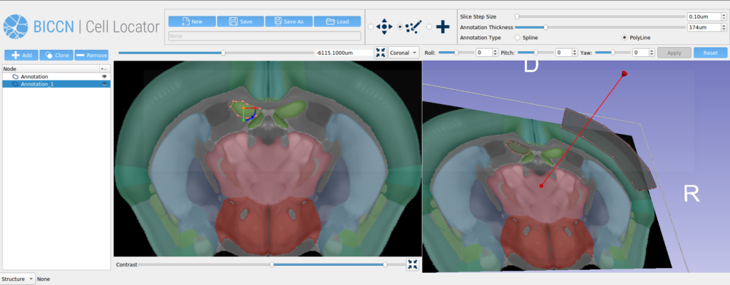 Cell Locator: Manually align specimens to annotated 3D spaces