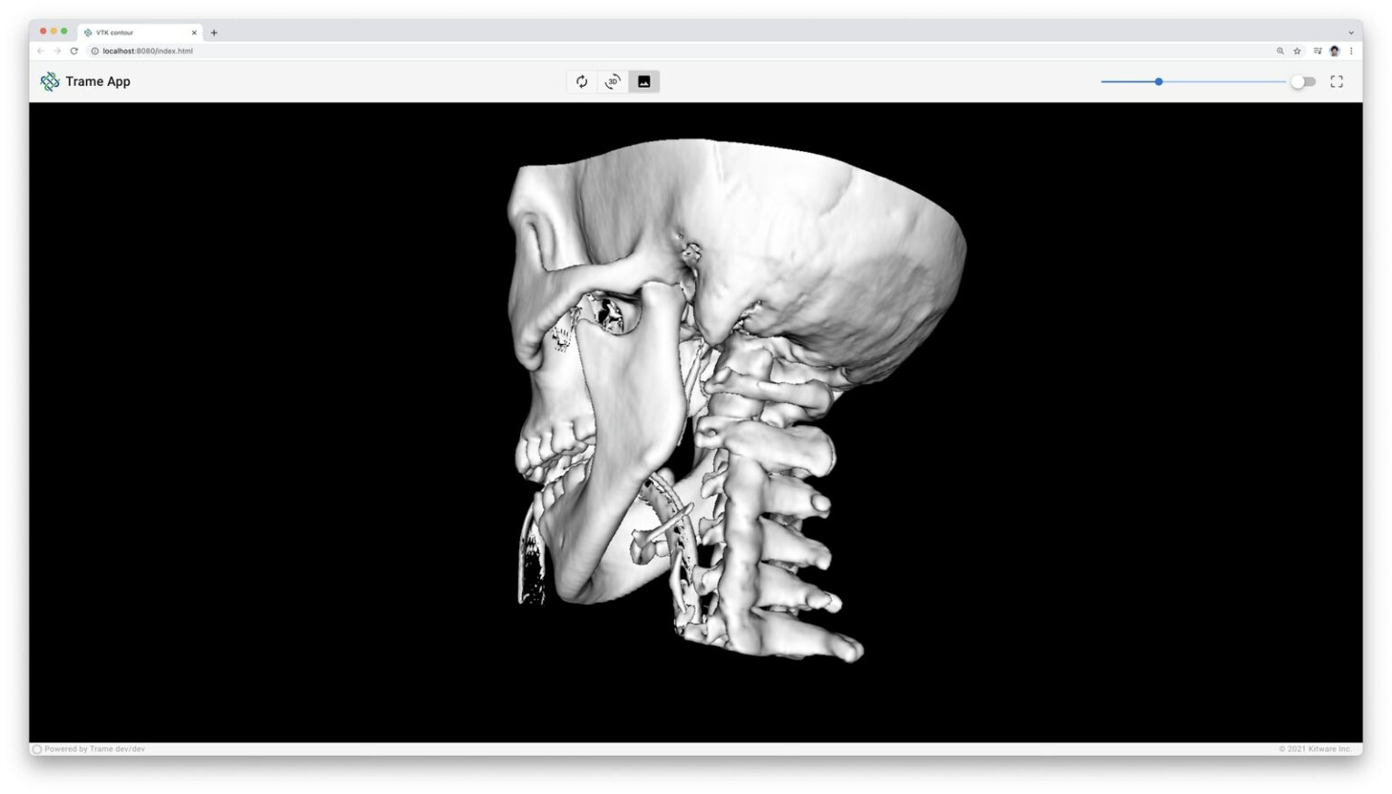 Delivering Innovation in Medical Image Visualization