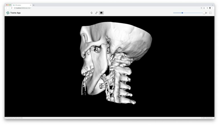 Delivering Innovation in Medical Image Visualization