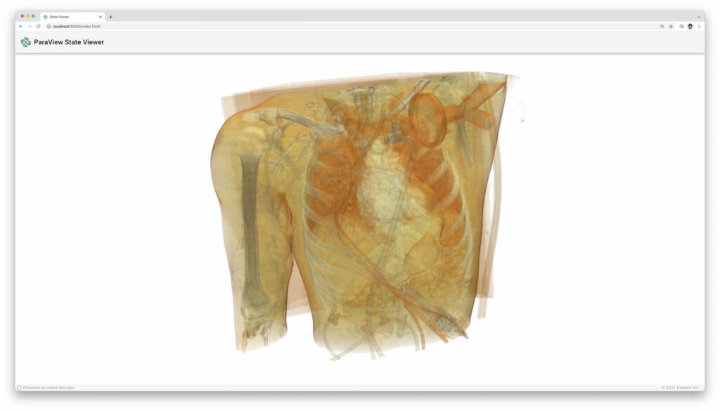 Delivering Innovation in Medical Image Visualization