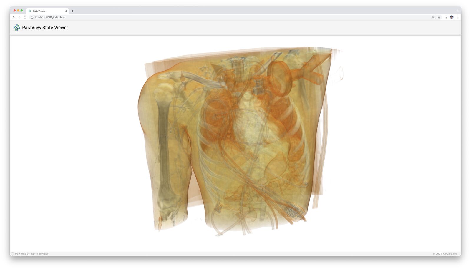 Delivering Innovation in Medical Image Visualization