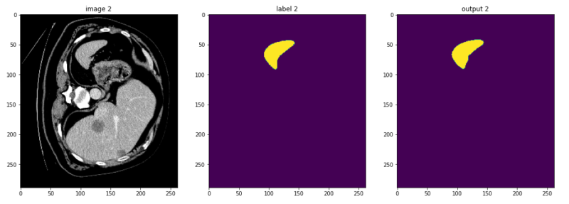 TensorBoardPlugin3D: Visualizing 3D Deep Learning Models in TensorBoard