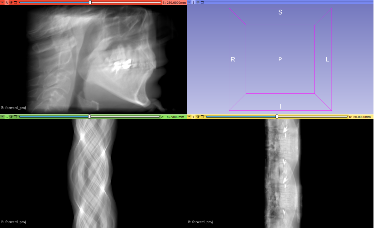 CT reconstruction using Slicer and RTK