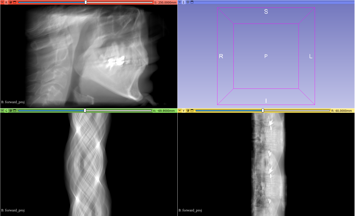 CT reconstruction using Slicer and RTK