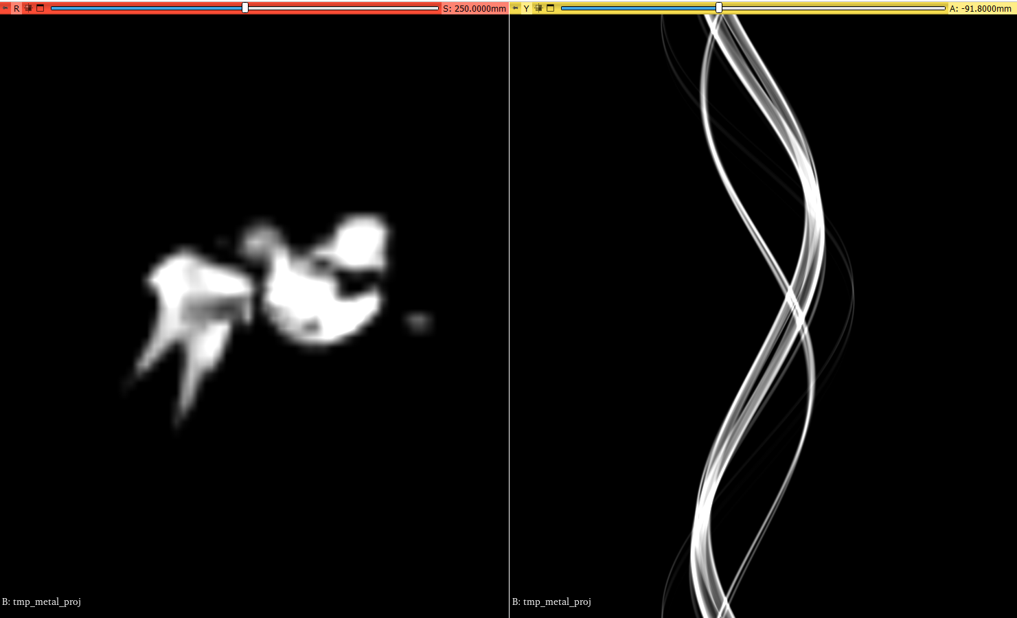CT reconstruction using Slicer and RTK