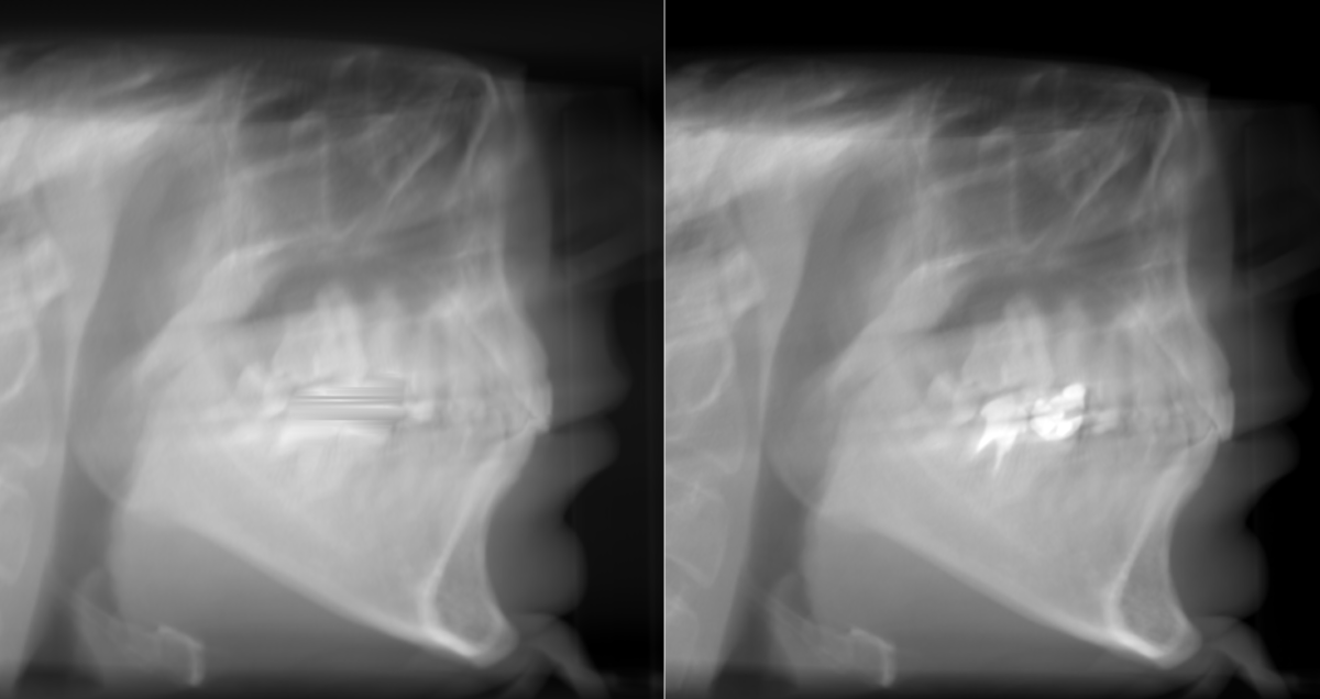 CT reconstruction using Slicer and RTK