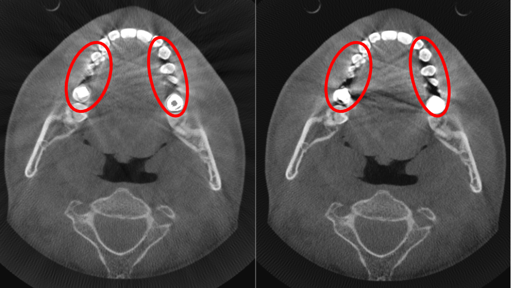 CT reconstruction using Slicer and RTK