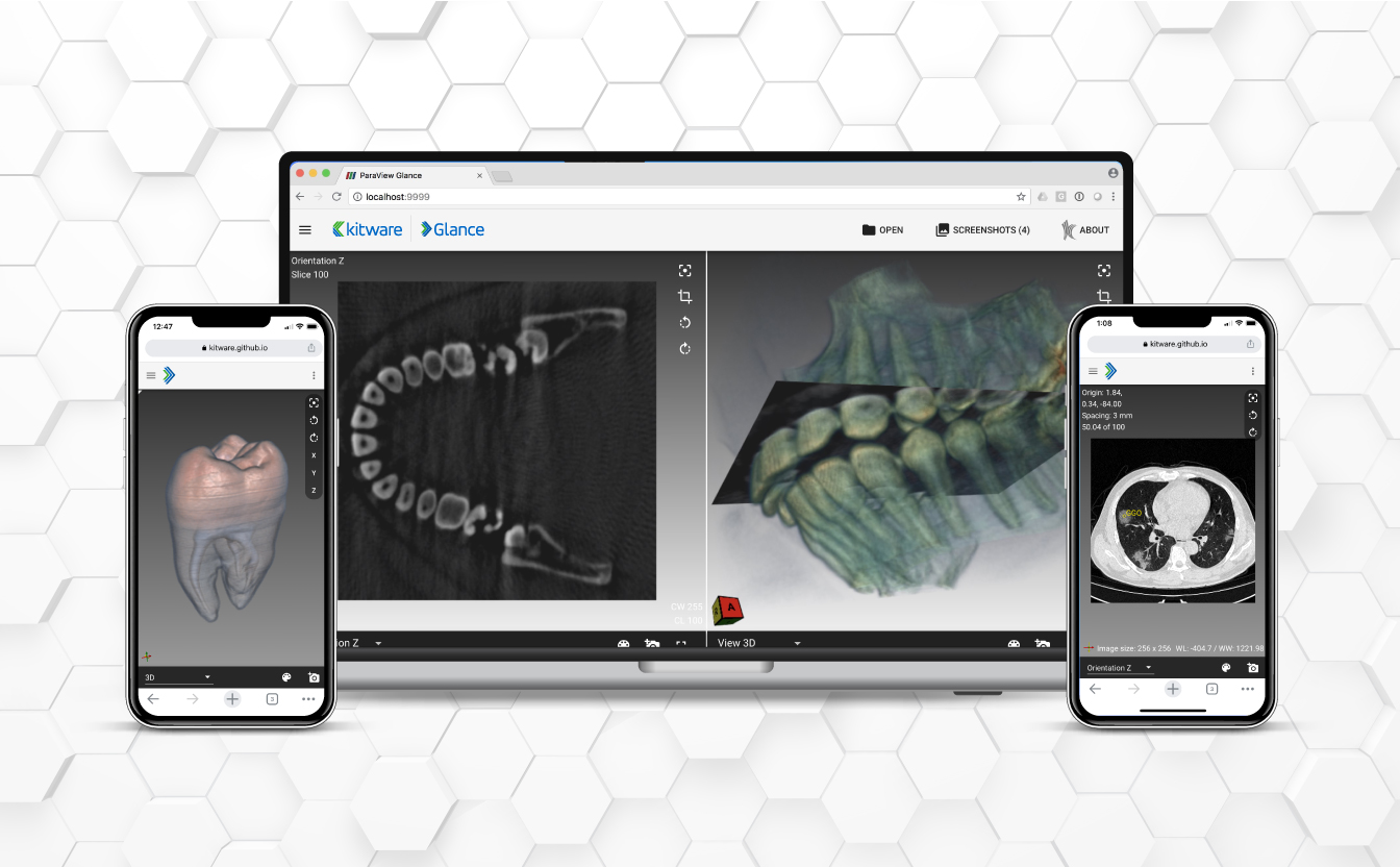 Leverage Kitware’s Expertise to Develop Your Mobile Medical Imaging ...