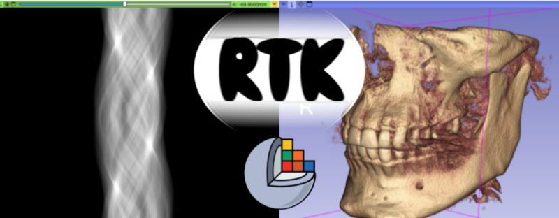 CT reconstruction using Slicer and RTK
