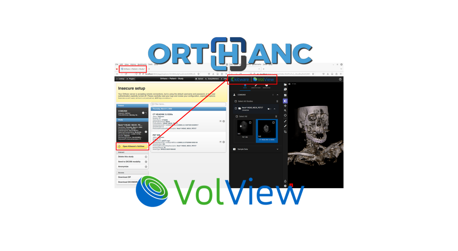 Orthanc and VolView: Integrating Cinematic Volume Rendering Into a PACS Web Interface