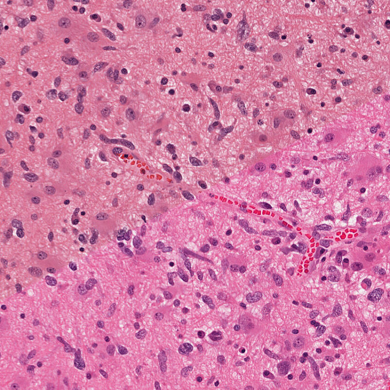 ICC Color Profile Correction: Harmonizing Color Spaces with HistomicsTK