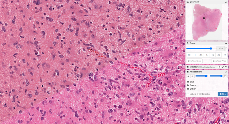 ICC Color Profile Correction: Harmonizing Color Spaces with HistomicsTK