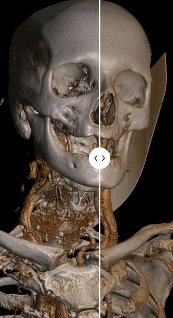 VolView 4.1 Includes Exciting Integrations With DICOMweb, Amazon, Google, and Orthanc