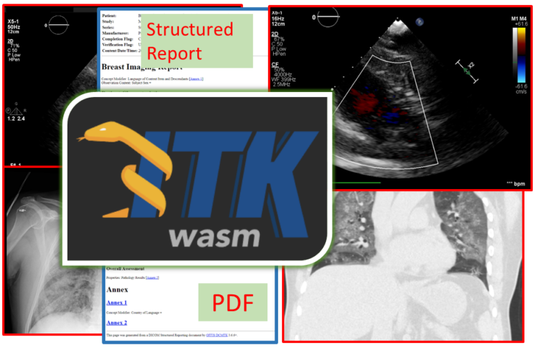 Reading Dicom Images And Non Image Sop Classes In Javascript And Python