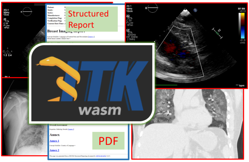 Reading Dicom Images And Non Image Sop Classes In Javascript And Python 1109