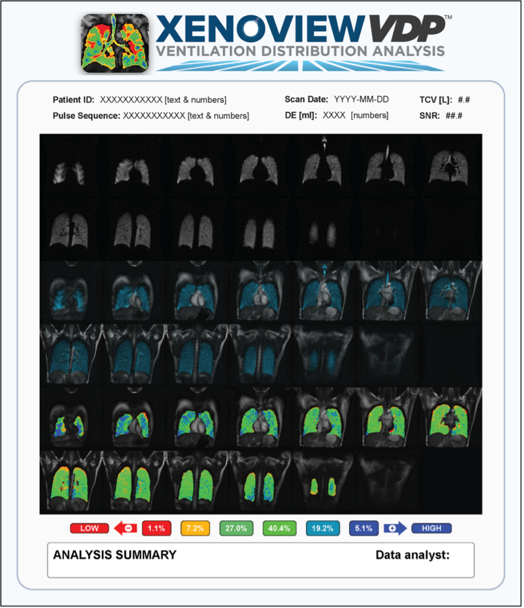 Kitware Supports Development and Launch of FDA Cleared MR Image ...
