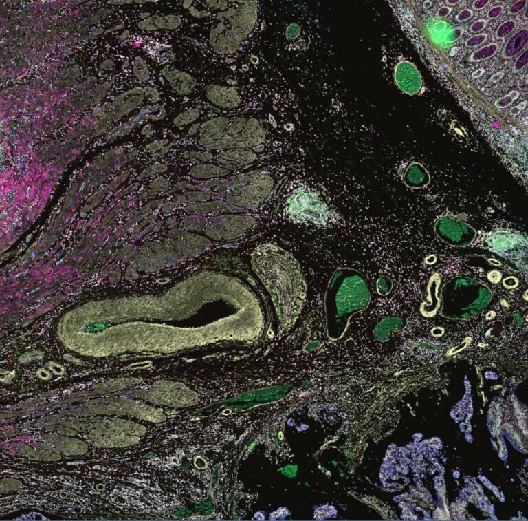Embracing Change in Digital Pathology: The Improved Large Image ...