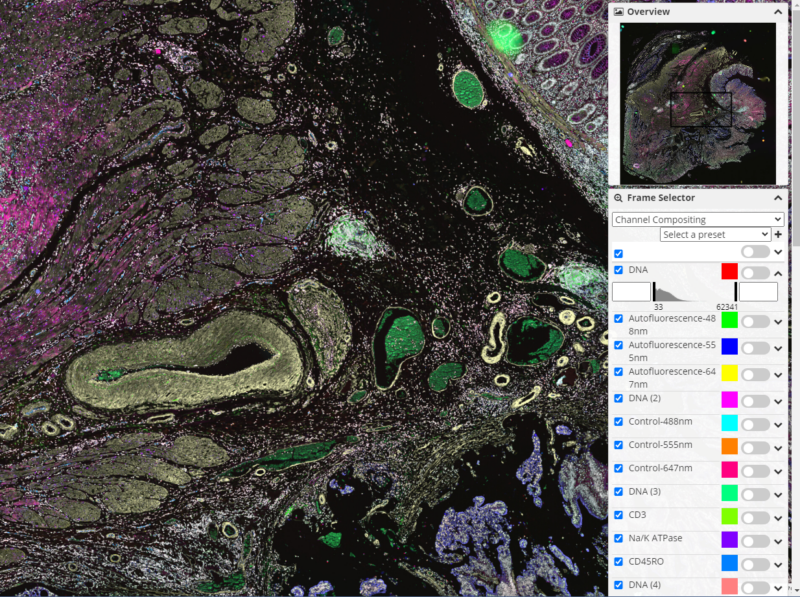 Embracing Change in Digital Pathology: The Improved Large Image ...
