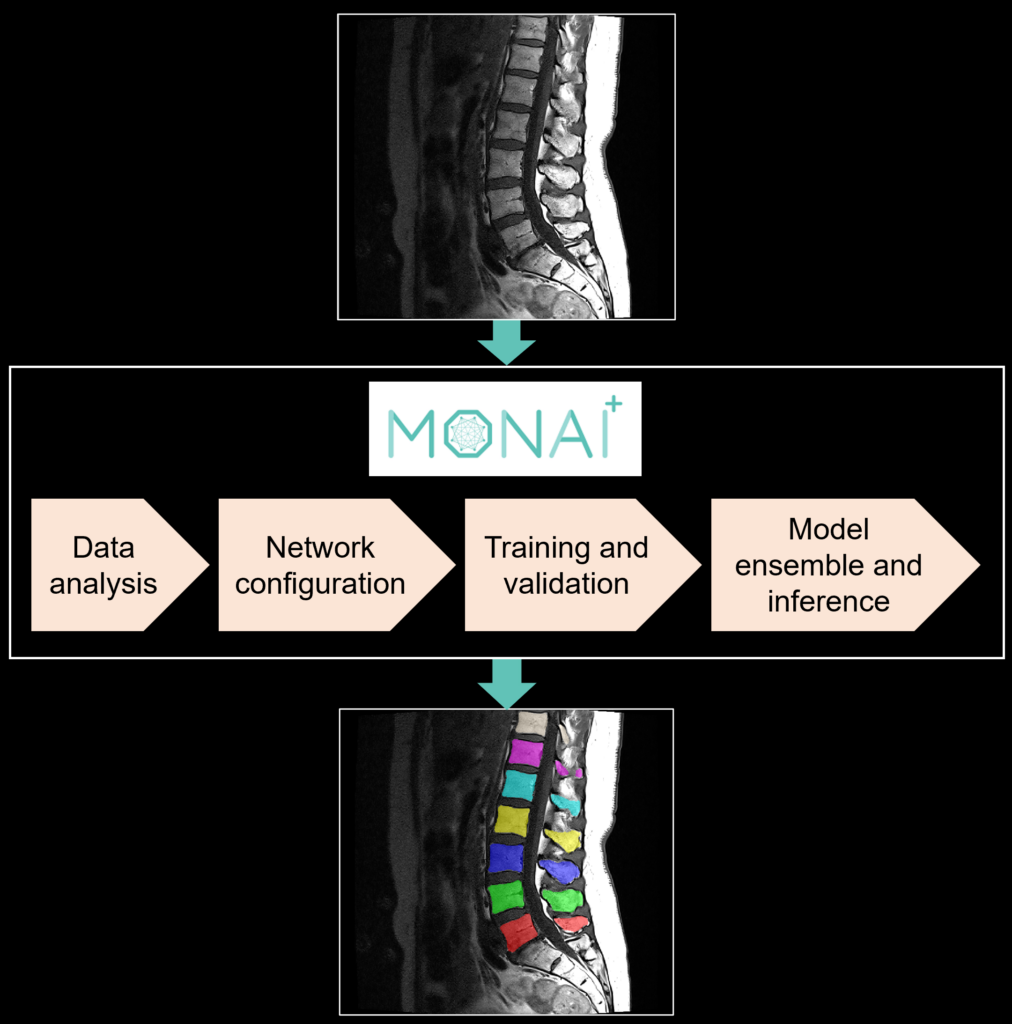 Developing custom 3D medical image segmentation solutions using out-of-the-box pipelines in MONAI