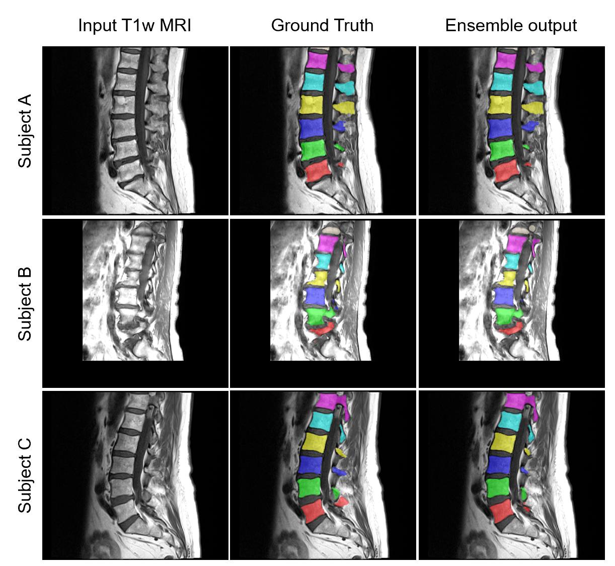 Developing custom 3D medical image segmentation solutions using out-of ...
