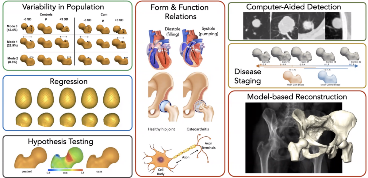 Harness The Power Of Statistical Shape Models With Open Source And Kitware Custom Solutions