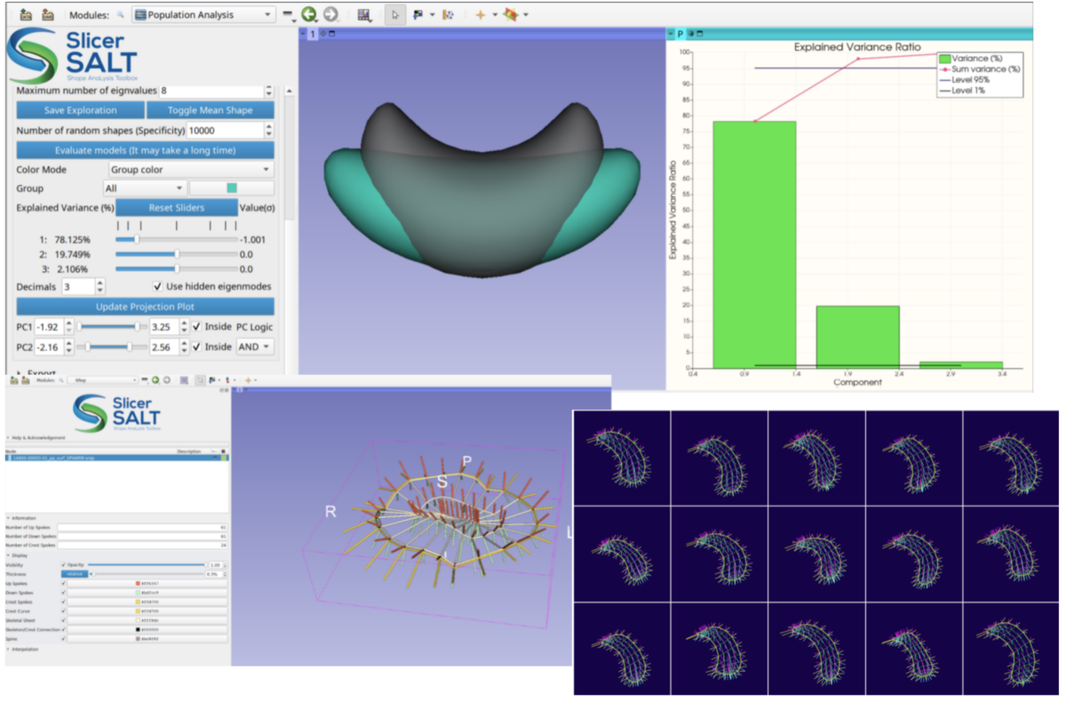 Harness the Power of Statistical Shape Models with Open Source and Kitware Custom Solutions
