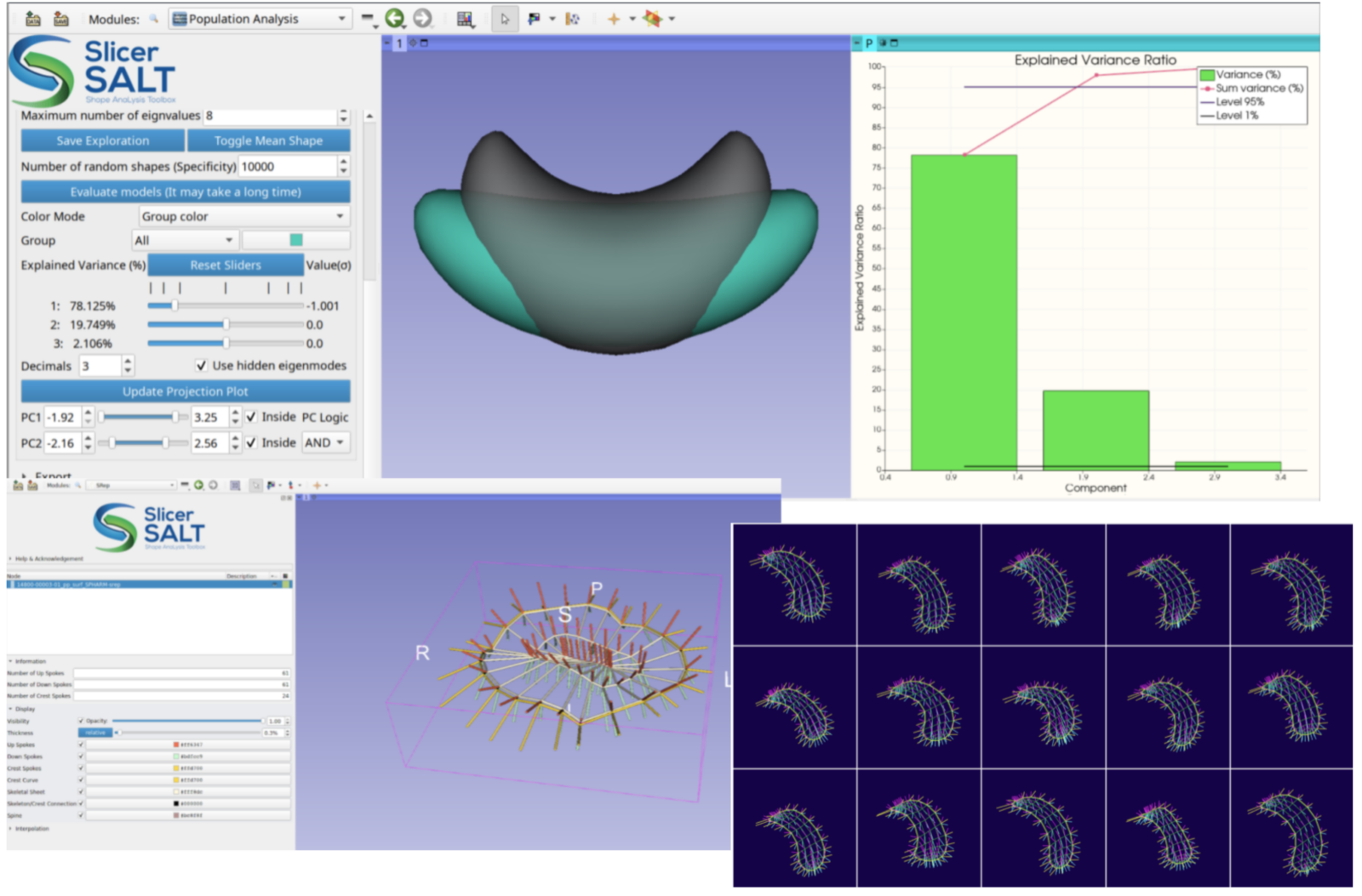 Harness The Power Of Statistical Shape Models With Open Source And Kitware Custom Solutions