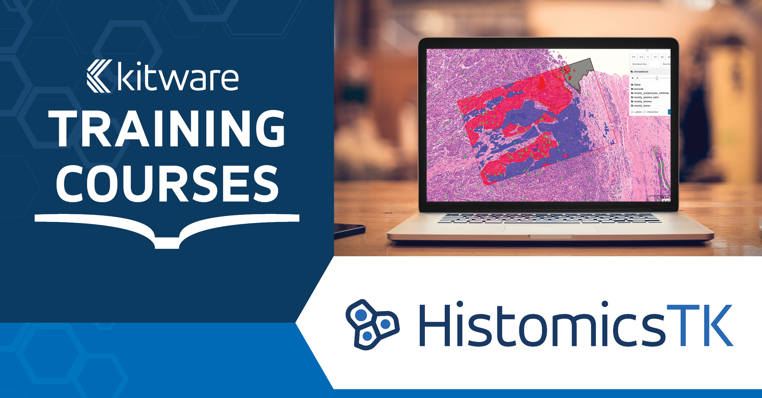 Intro to HistomicsTK