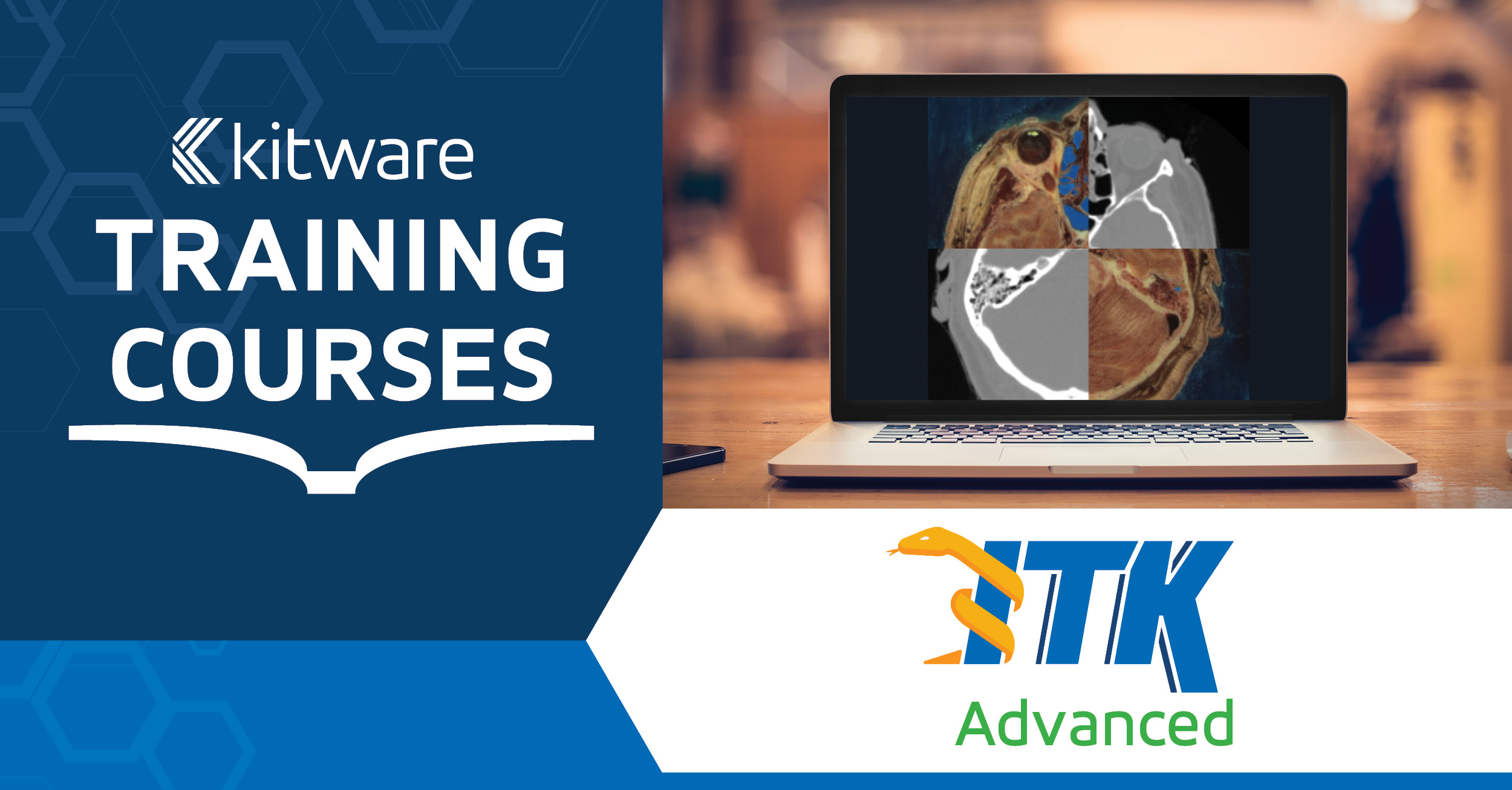 ITK Advanced Course