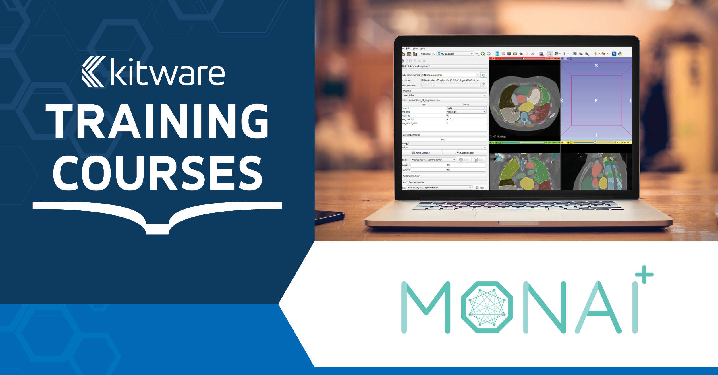 Practical MONAI: Integrating AI Into Research, Processes, and Products ...