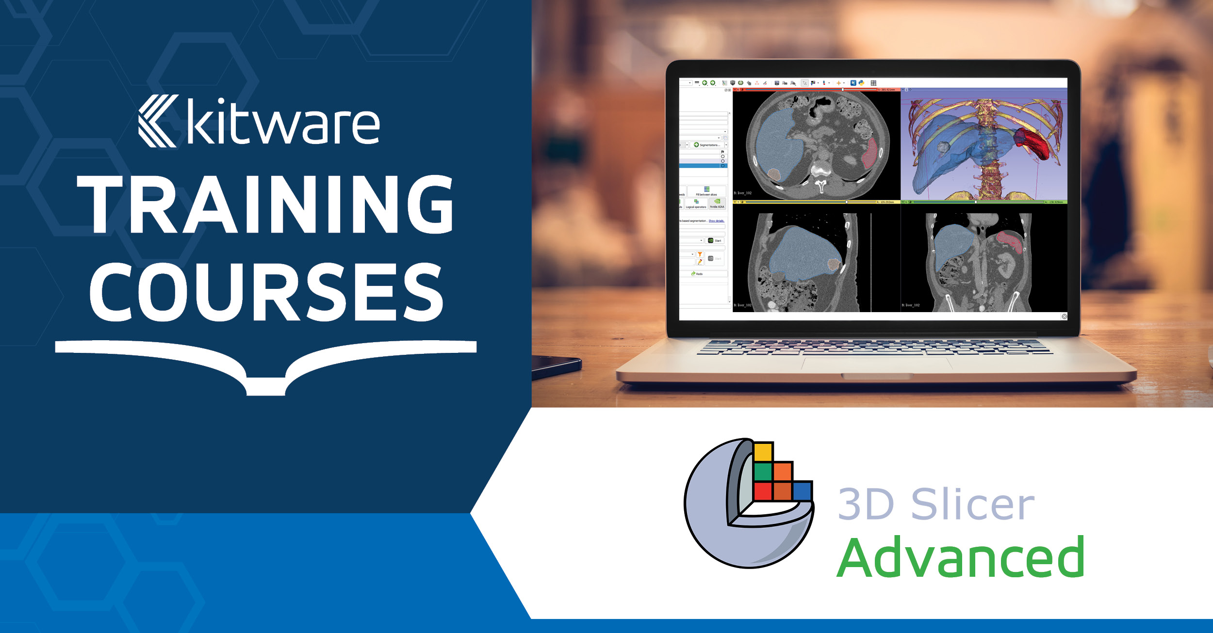 Advanced 3D Slicer Course: Scripting and Customization