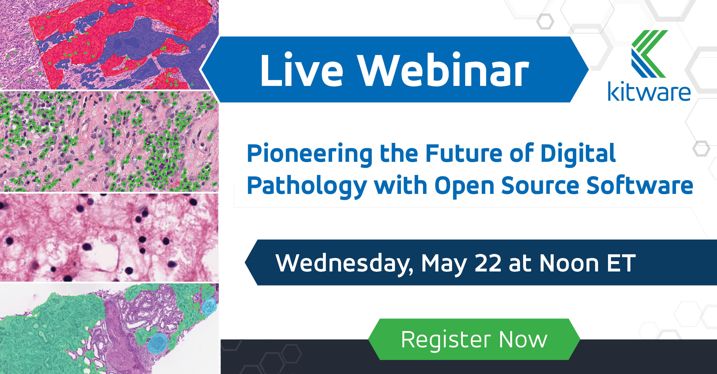 Pioneering the Future of Digital Pathology with Open Source Software